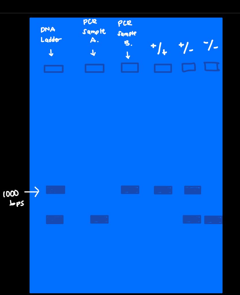 Solved DNA Ladder PCR Sample A. PER Sample 3. +/- +/-% I 个 | Chegg.com