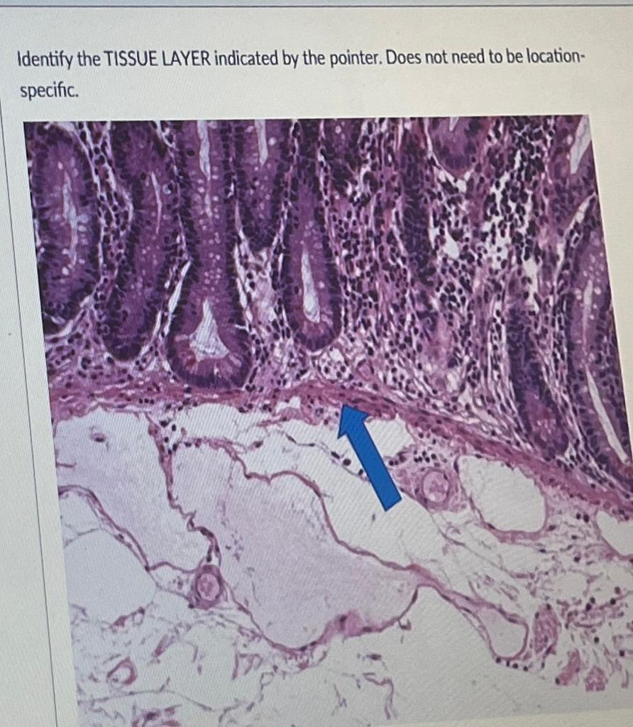 Identify the TISSUE LAYER indicated by the pointer. | Chegg.com