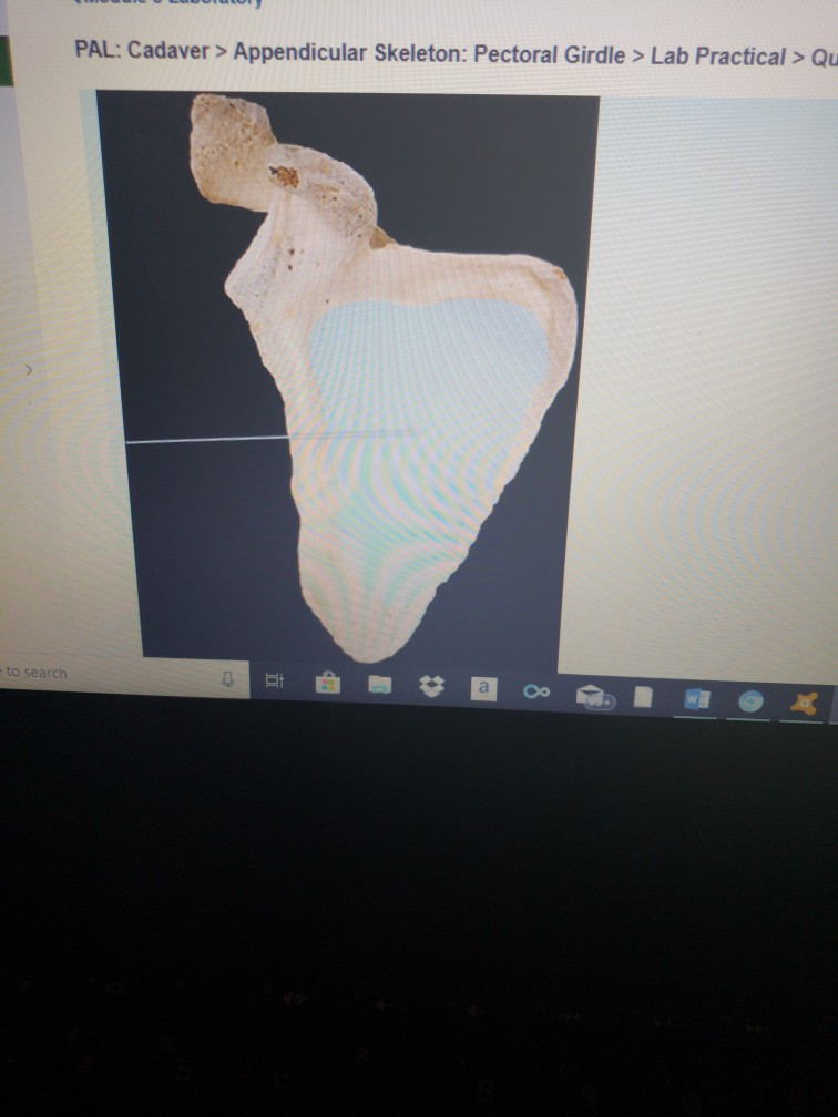 Solved PAL: Cadaver> Appendicular Skeleton: Pectoral Girdle | Chegg.com