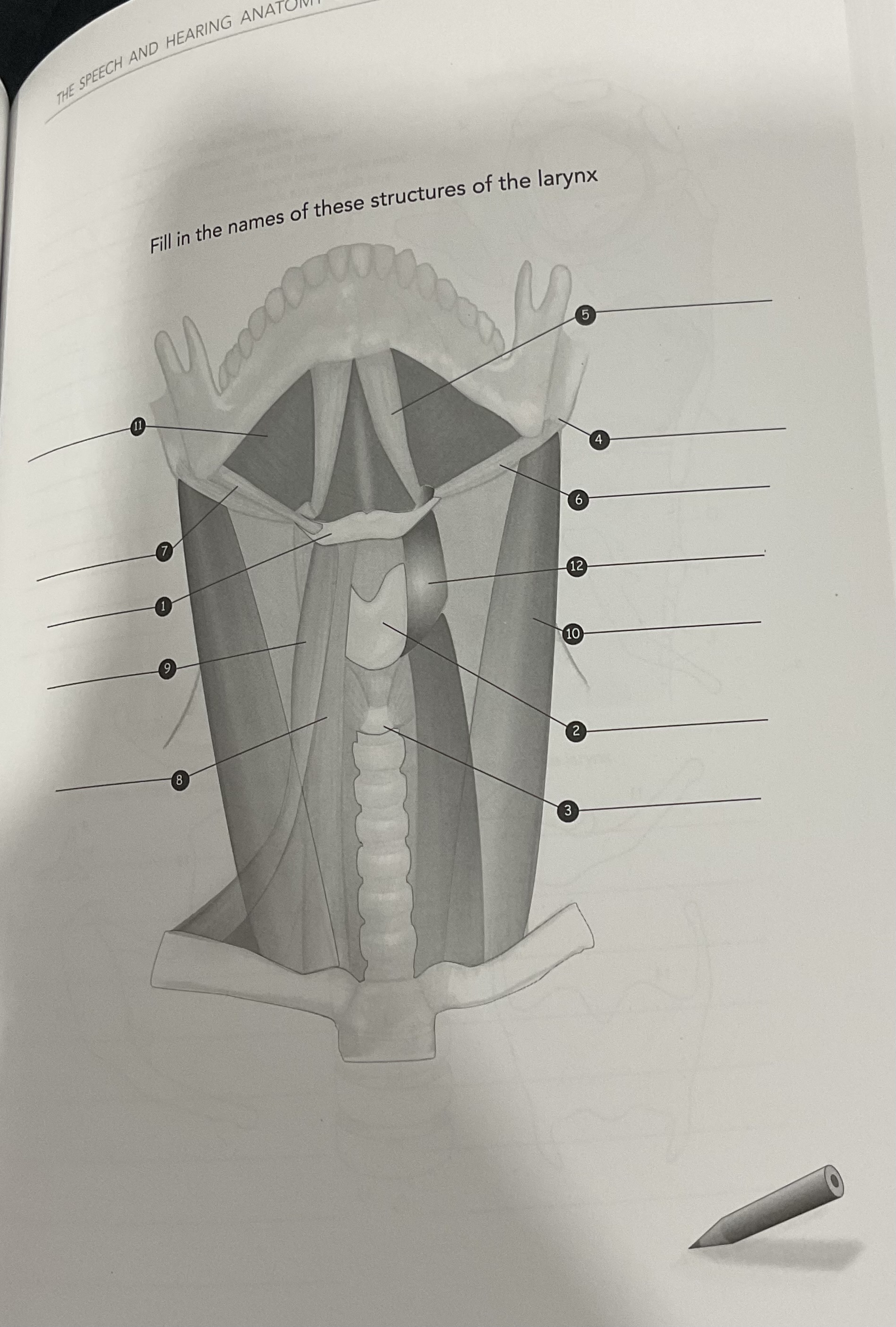 Fill in the names of these structures of the larynx | Chegg.com