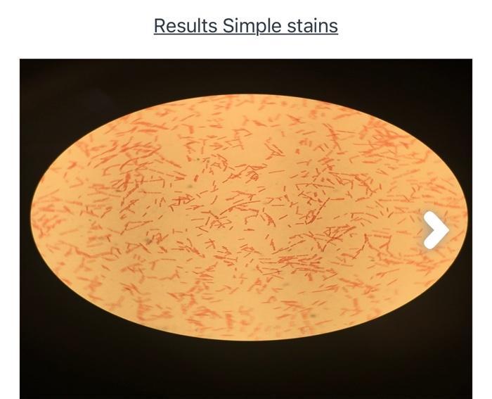 Solved Simple stain procedure: •Simple stain •Smears from | Chegg.com