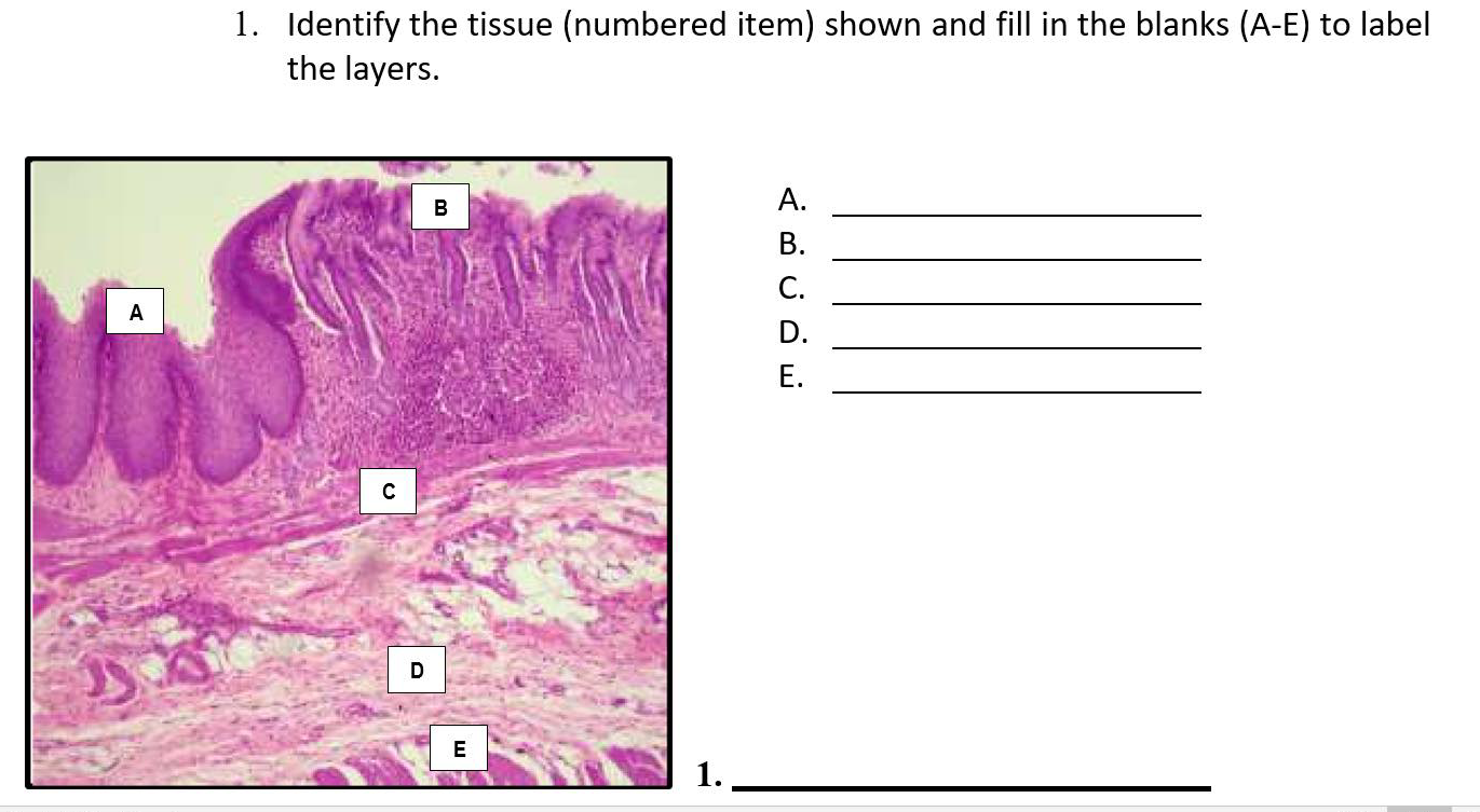 Solved 1. Identify the tissue (numbered item) shown and fill | Chegg.com