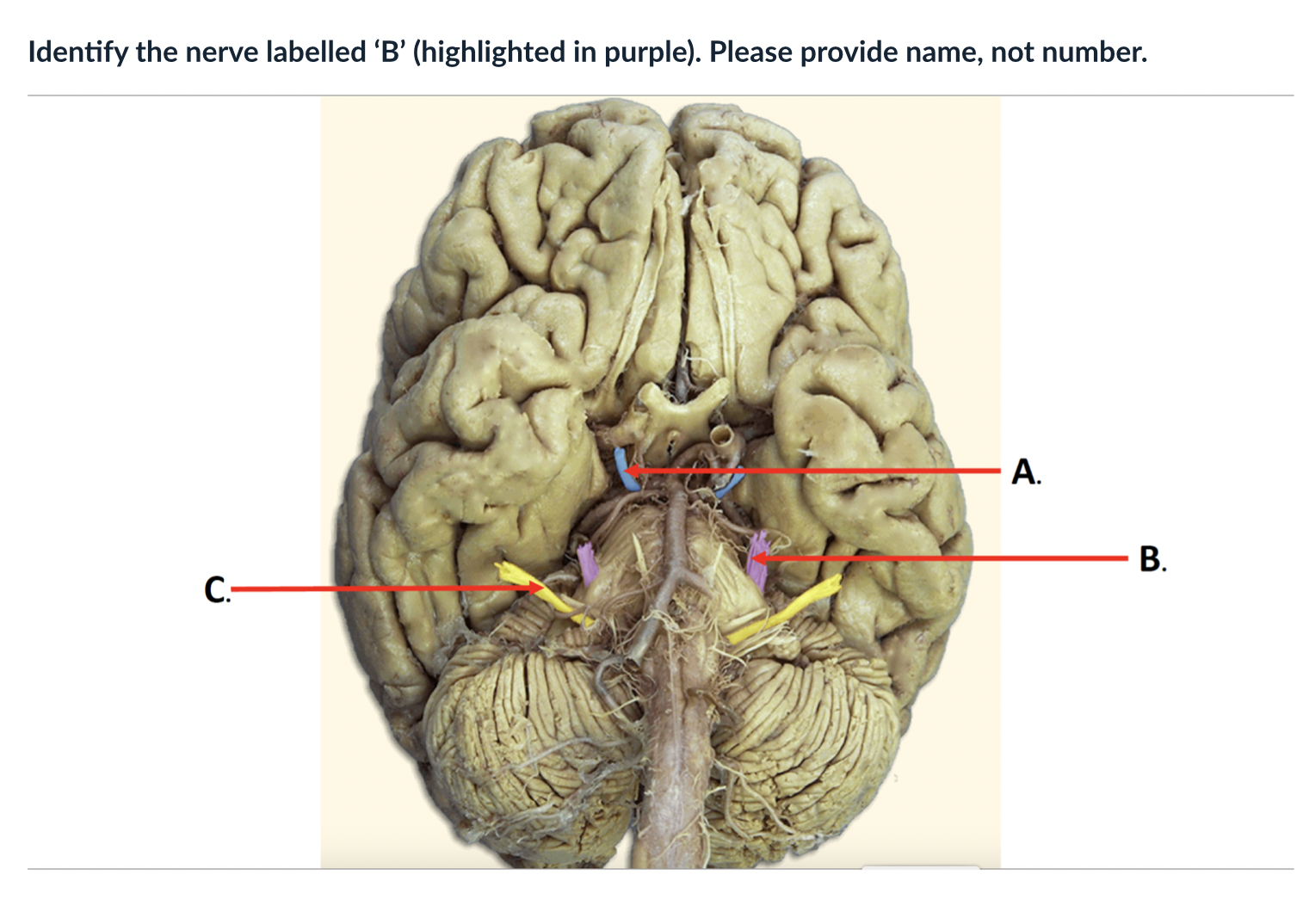 Solved Identify the nerve labelled ' B ' (highlighted in | Chegg.com