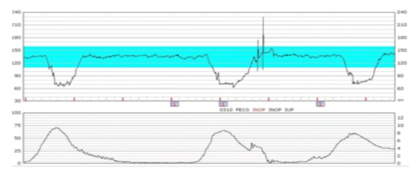 Solved FHR IS There a | Chegg.com