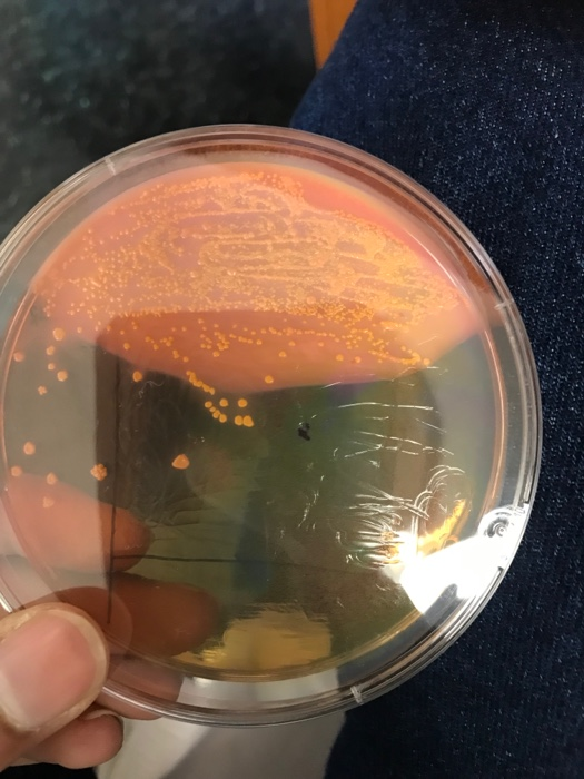 Solved What bacteria is this that grew on this TSA agar? It | Chegg.com