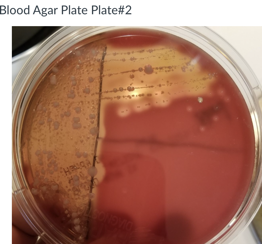 How many different types of colonies can you detect | Chegg.com