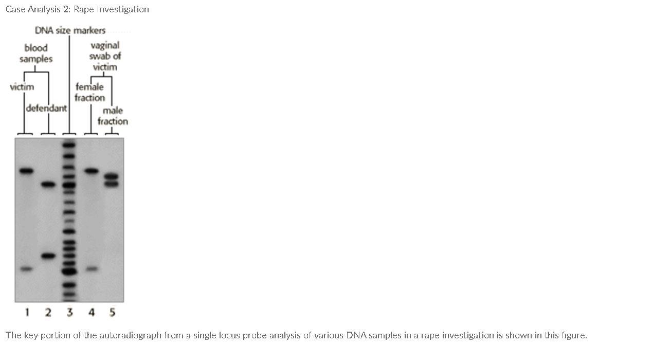 Solved Case Analysis 2: Rape Investigation DNA size markers | Chegg.com