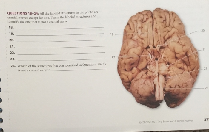 Brain And Cranial Nerves Quiz
