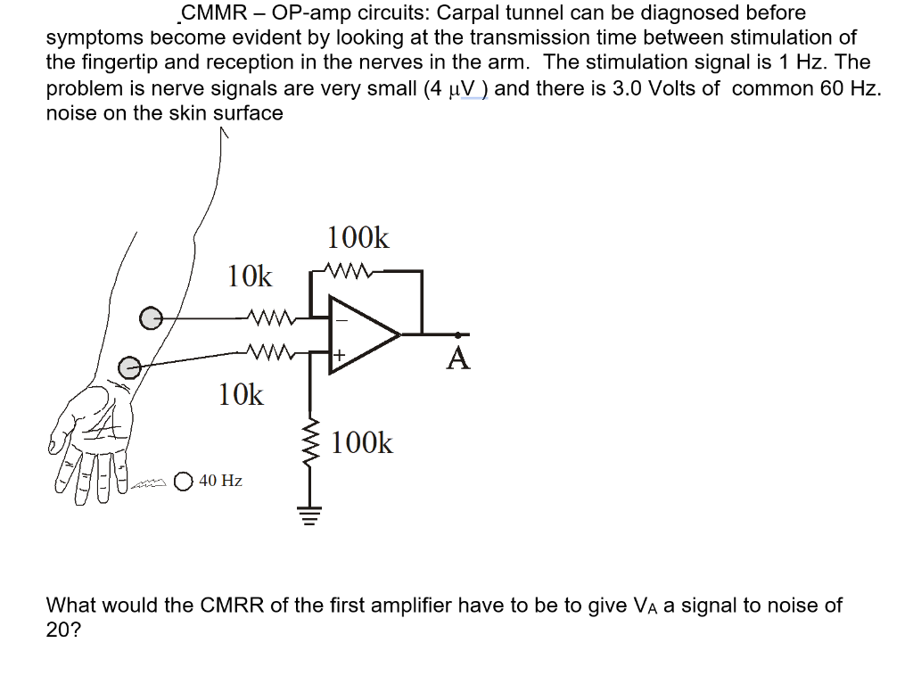 Solved CMMR - OP-amp circuits: Carpal tunnel can be | Chegg.com