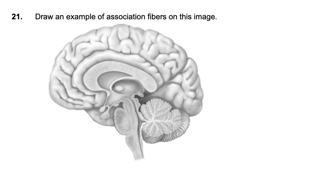 Solved 1. Draw an example of association fibers on this | Chegg.com