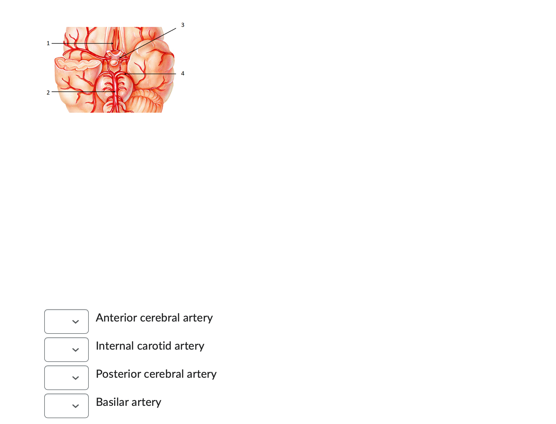 Solved Anterior cerebral artery Internal carotid artery | Chegg.com