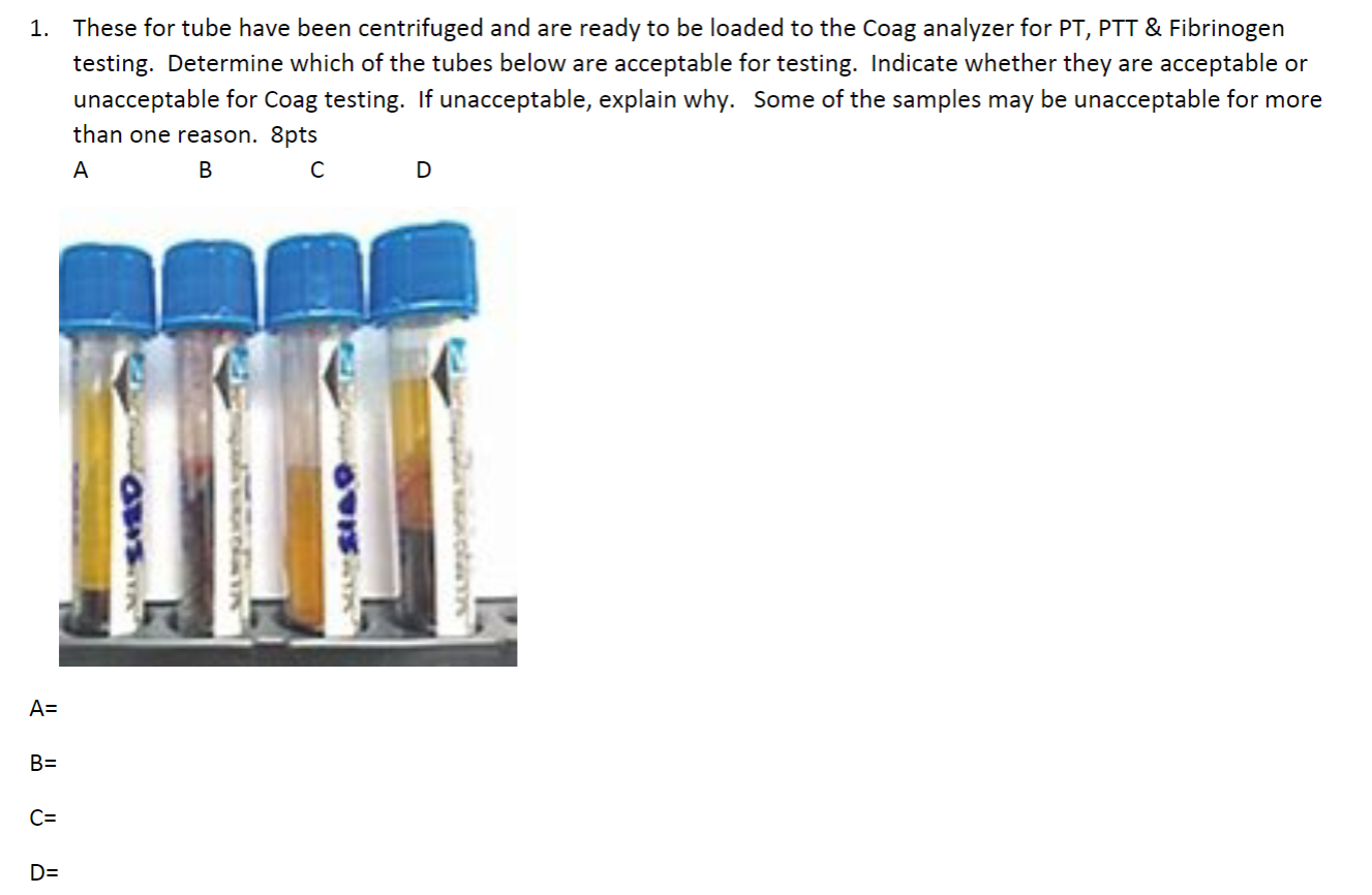 Solved 1. These for tube have been centrifuged and are ready | Chegg.com