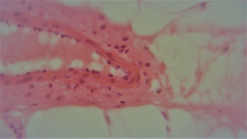 [Solved]: Label the tunica externa, tunica media, and tunica