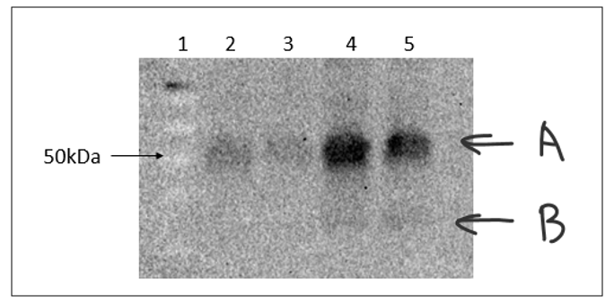 Solved Western Blot: Cell Biology The figure shown above | Chegg.com