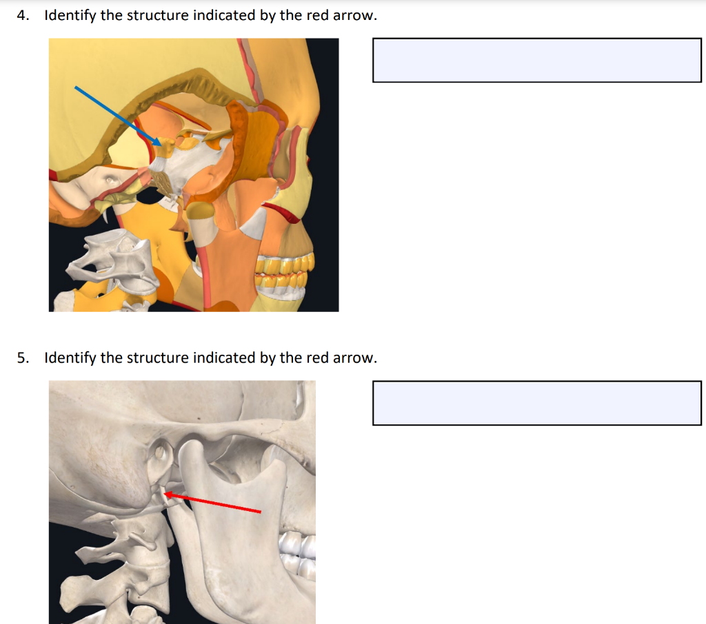 Solved 4. Identify the structure indicated by the red arrow. | Chegg.com