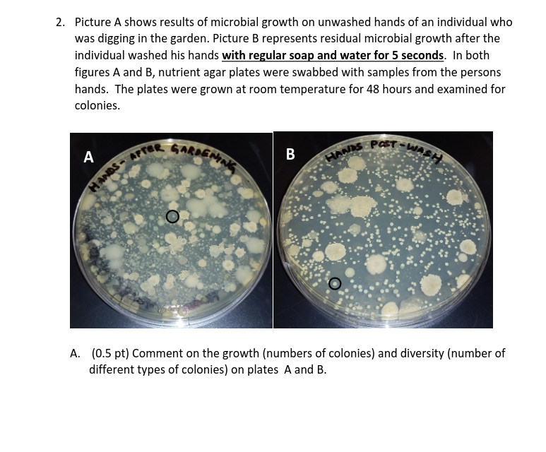 Solved Picture A shows results of microbial growth on | Chegg.com