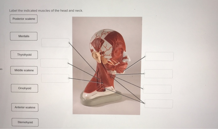 Solved Label the indicated muscles of the head and neck | Chegg.com