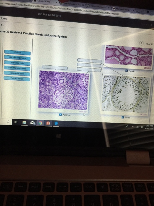 Solved 10 of 10 ercise 33 Review & Practice Sheet: Endocrine | Chegg.com