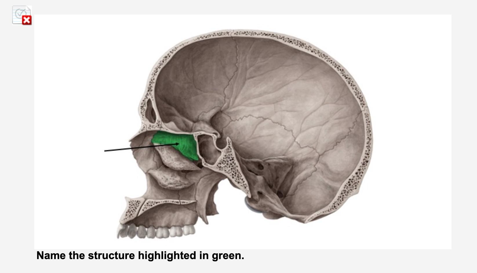 Solved Name the structure highlighted in green. | Chegg.com