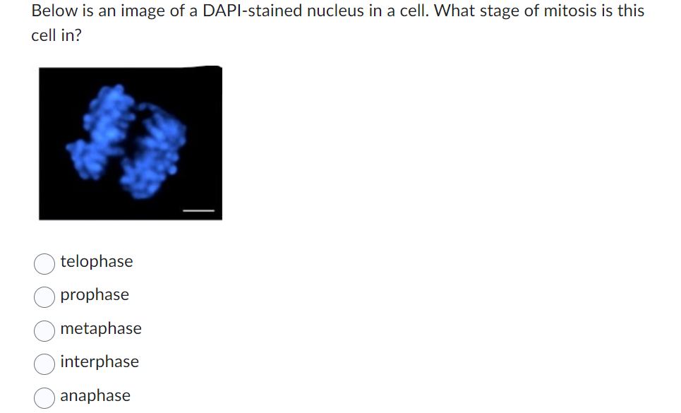 Solved Below is an image of a DAPI-stained nucleus in a | Chegg.com