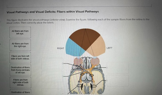 Solved Visual Pathways and Visual Deficits: Fibers within | Chegg.com