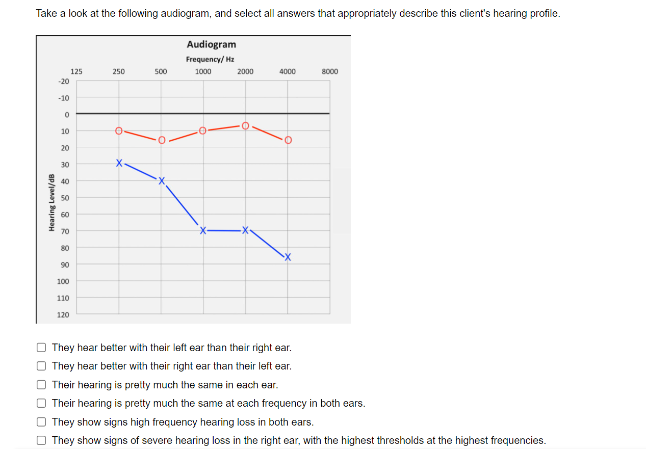 Take a look at the following audiogram, and select | Chegg.com