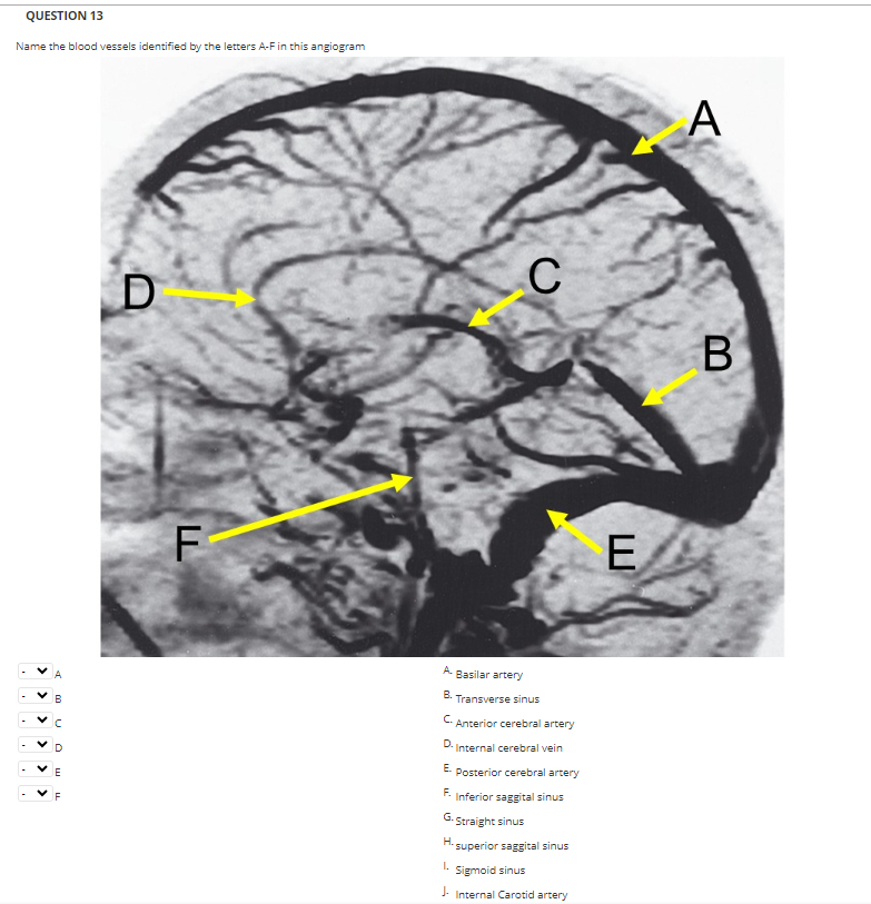 Solved Name the blood vessels identified by the letters A-F | Chegg.com