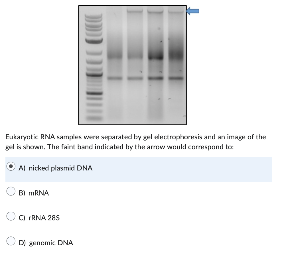 Solved Eukaryotic RNA samples were separated by gel | Chegg.com
