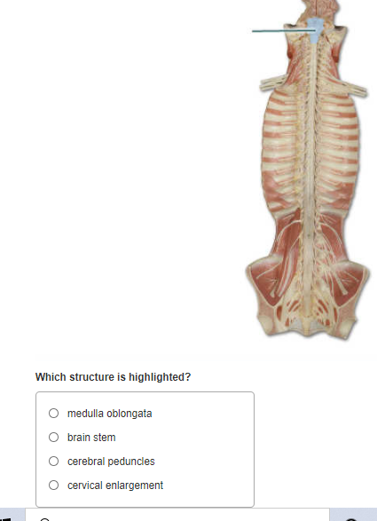 Solved Which structure is highlighted? O medulla oblongata | Chegg.com