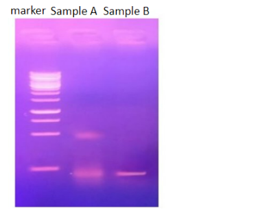 Solved Image of Agarose Gel Electrophoresis (After | Chegg.com