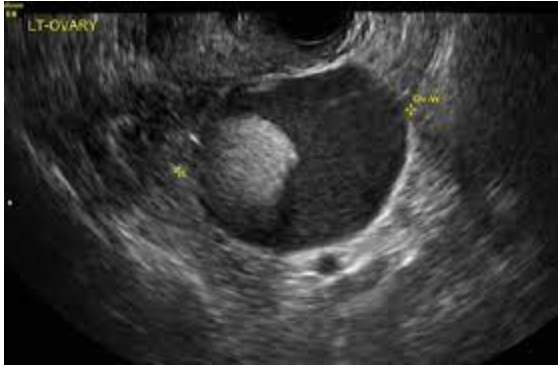 Solved Describe These Two Images In Sonographic Terms What