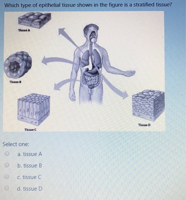 Solved Which type of epithelial tissue shown in the figure | Chegg.com