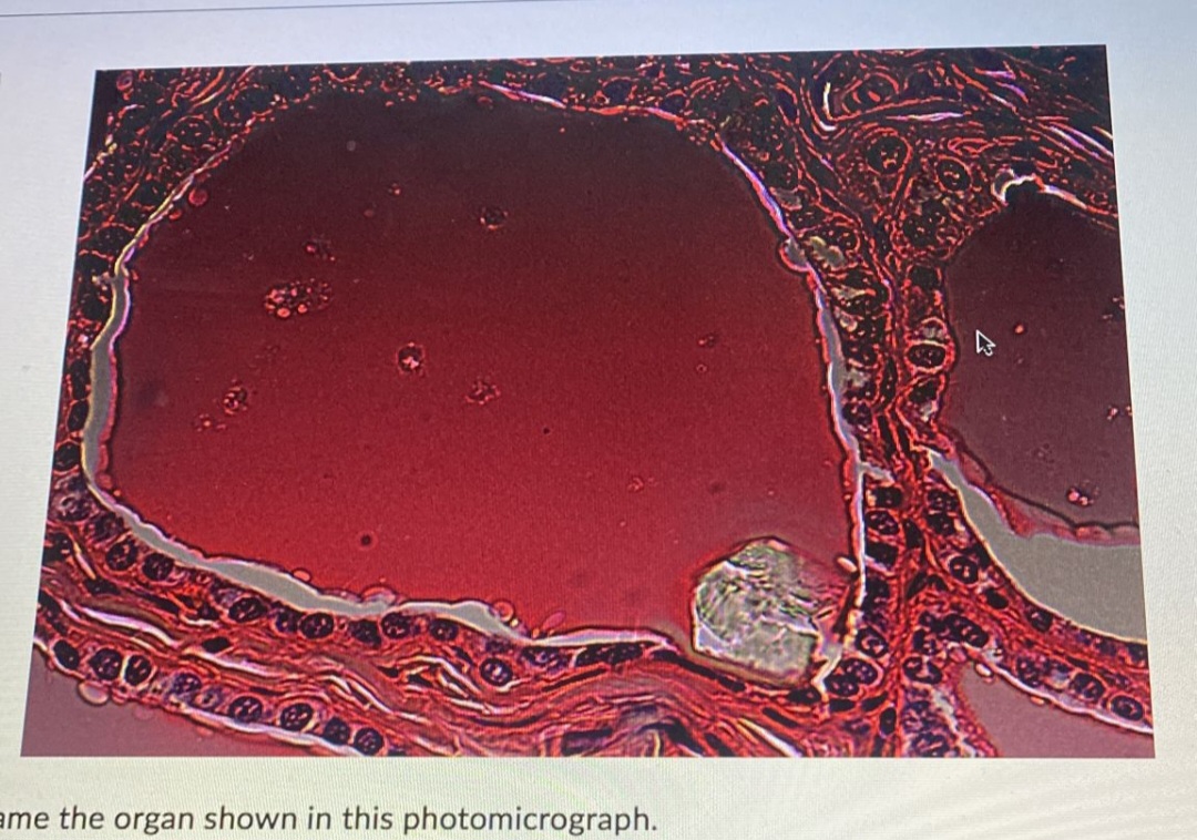 Solved the organ shown in this photomicrograph. me | Chegg.com