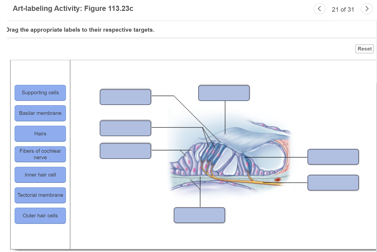 Solved Art-labeling Activity: Figure 13.21b (2 of 2) Drag | Chegg.com Solved Art-labeling Activity: Figure 13.21b (2 of 2) Drag | Chegg.com