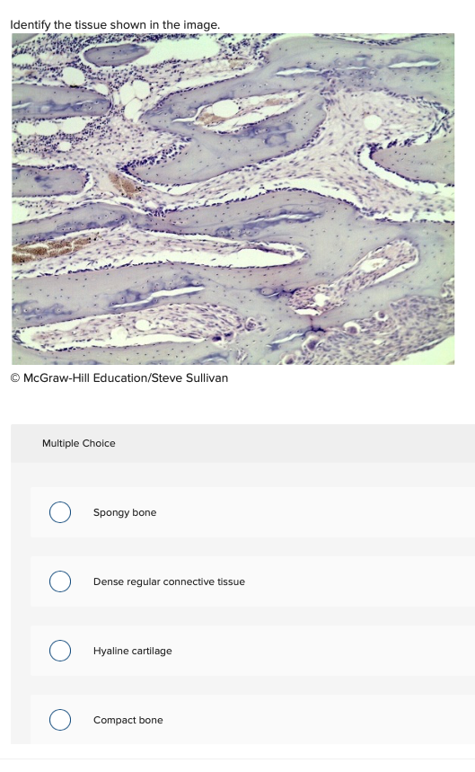 Solved Multiple Choice Spongy bone Dense regular connective | Chegg.com