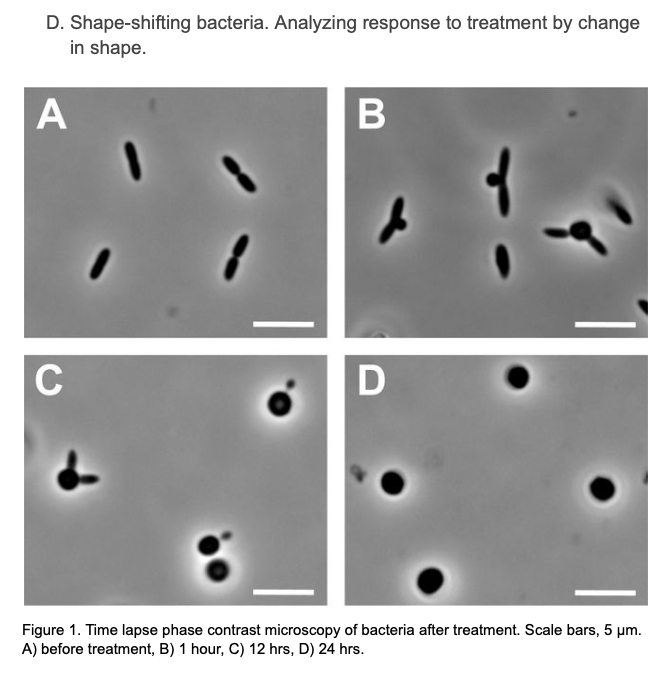 Solved D. Shape-shifting bacteria. Analyzing response to | Chegg.com