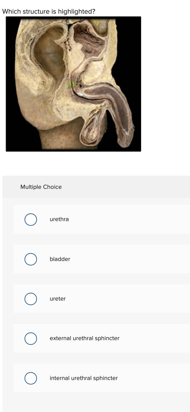 Solved Which structure is highlighted? Multiple Choice | Chegg.com
