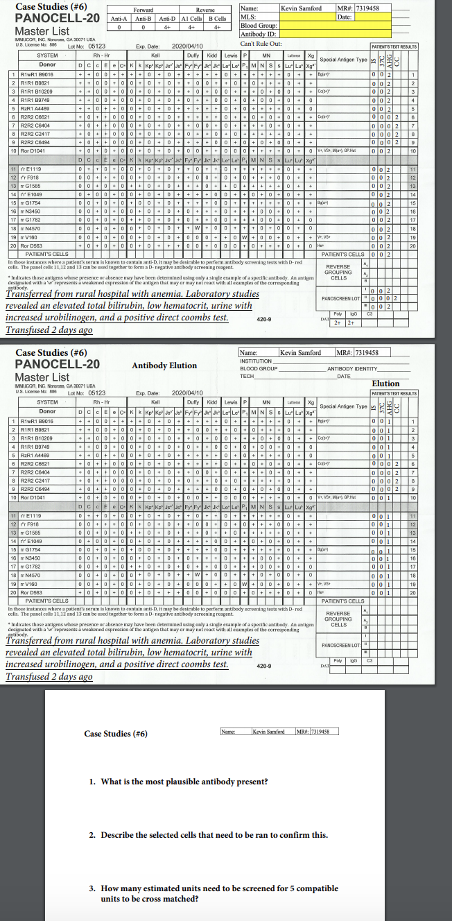 0 + + Case Studies (#6) Forward Reverse Name Kevin | Chegg.com
