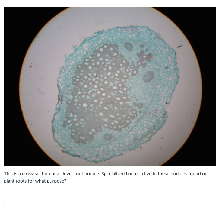 Solved This Is A Cross Section Of A Clover Root Nodule