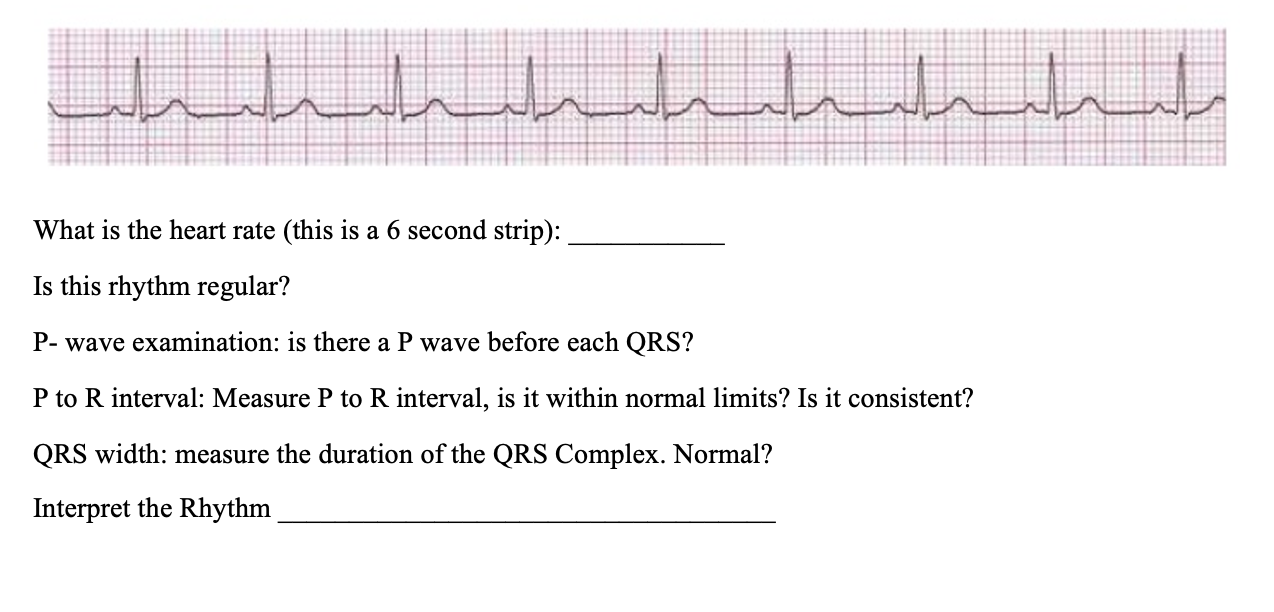 Solved What is the heart rate (this is a 6 ﻿second strip):Is | Chegg.com