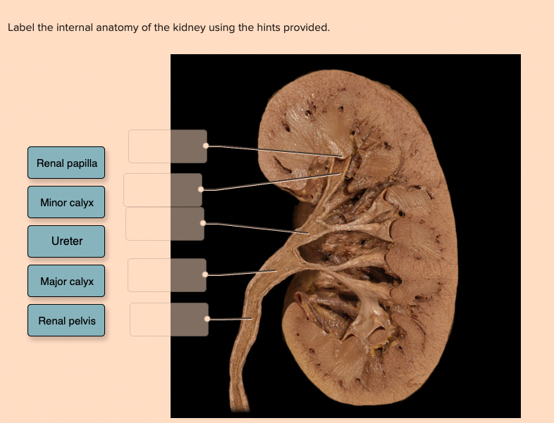 Solved Label the internal anatomy of the kidney using the | Chegg.com