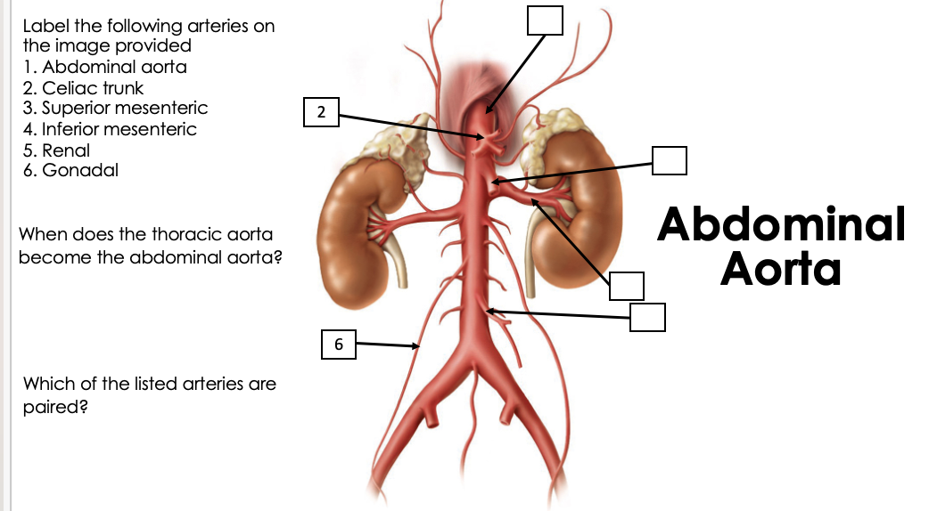 Solved Label The Following Arteries On The Image Provided