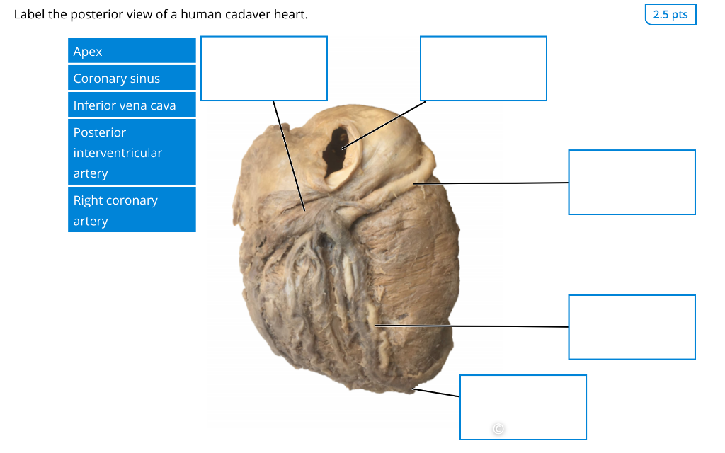 [Solved]: Label the layers of the pericardium and heart wa