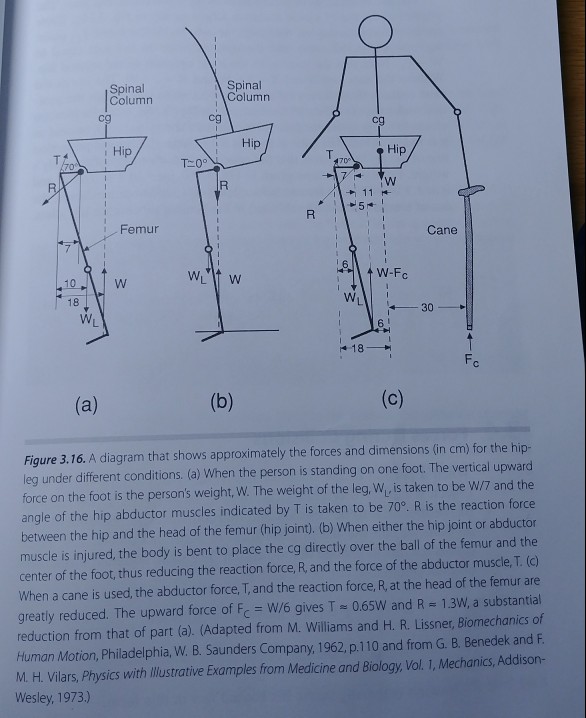 Solved Spinal Column Spinal Column Hip Hip T:0° Femur Cane | Chegg.com