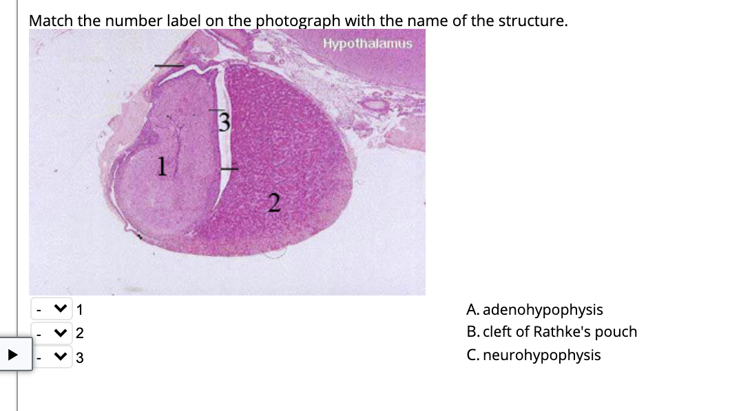 Solved Match the number label on the photograph with the | Chegg.com