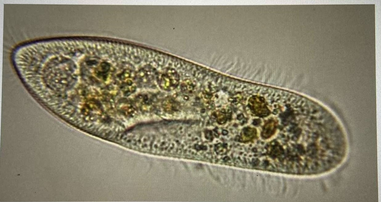 Solved Identify the type of protist and the phylum it | Chegg.com