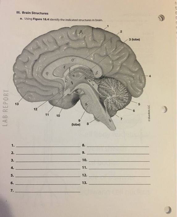 Solved III. Brain Structures Using Figure 18.4 identify the | Chegg.com Solved III. Brain Structures Using Figure 18.4 identify the | Chegg.com