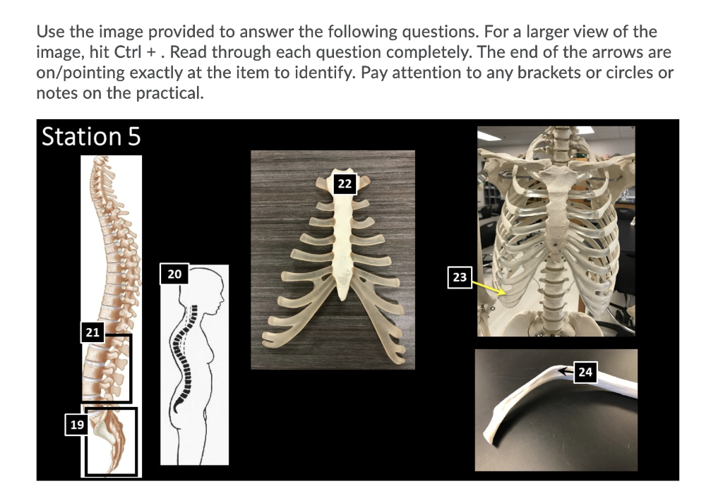 Solved - Name the abnormal curvature of the vertebral column | Chegg.com