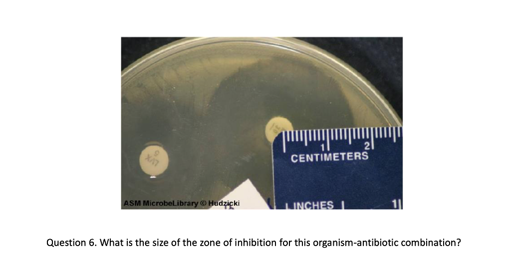 Solved TIT XAT CENTIMETERS ASM MicrobeLibrary © Hudzicki | Chegg.com