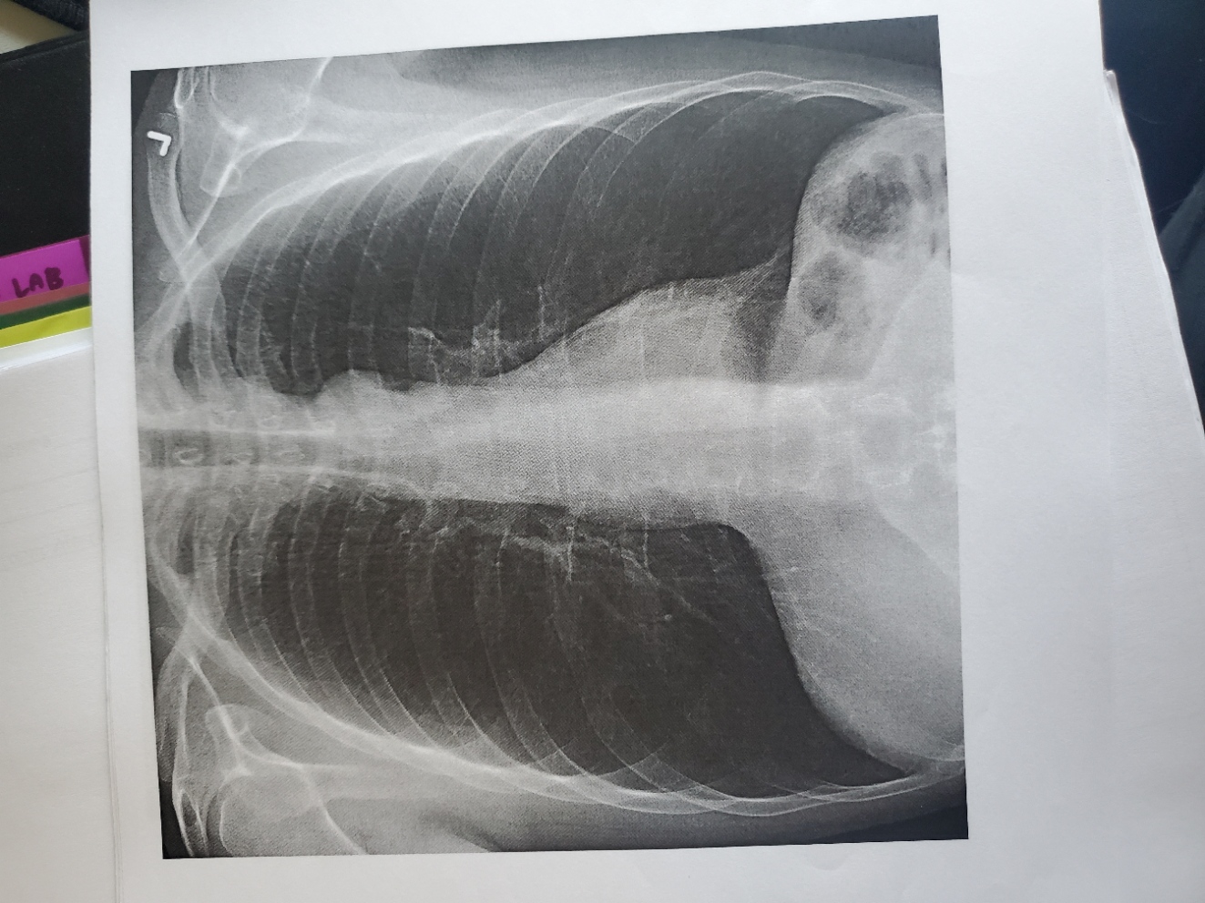 Solved 12- interpret this CXR and explain reasoning behind | Chegg.com